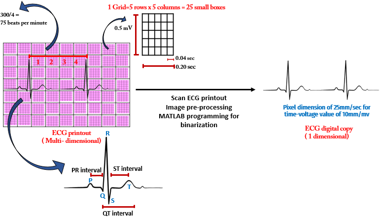 Digitization of ECG paper records using waveform extraction and conversion into 1D signals ...